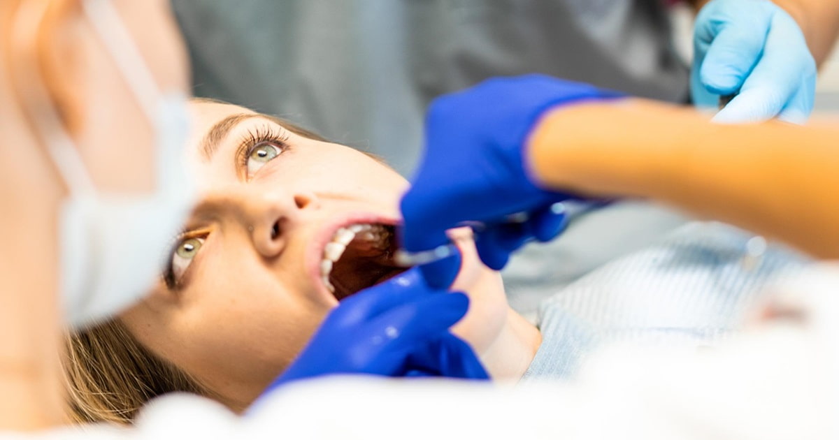 Wisdom Teeth Removal Recovery Timeline Guide